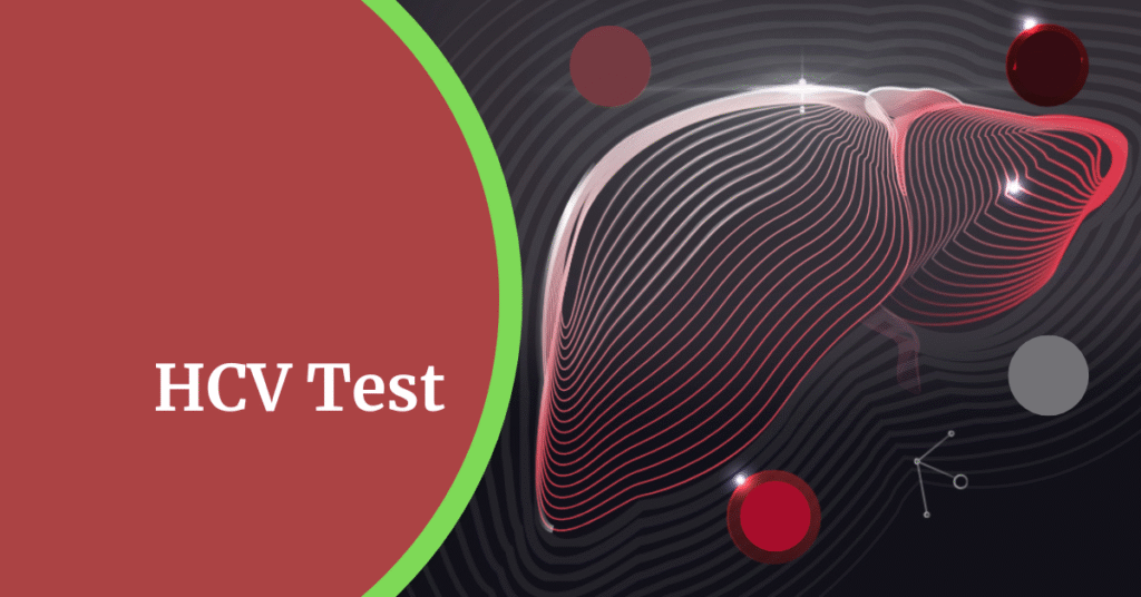 Understanding the HCV Test: Your First Step Toward Better Liver Health ...